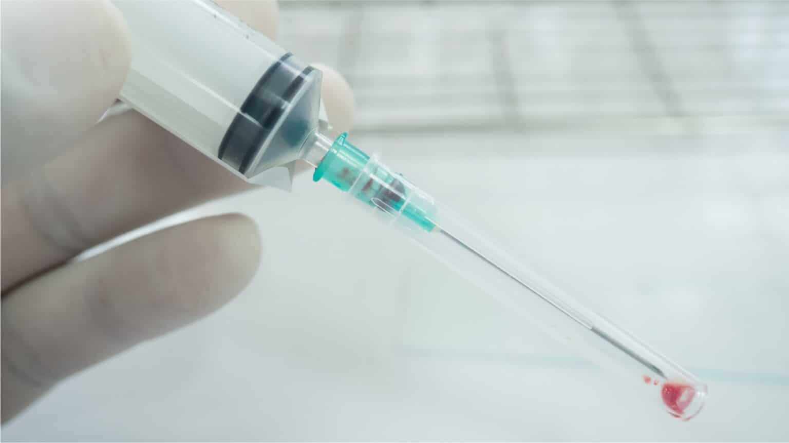 Biópsia de mama guiada por ultrassom: entenda o procedimento